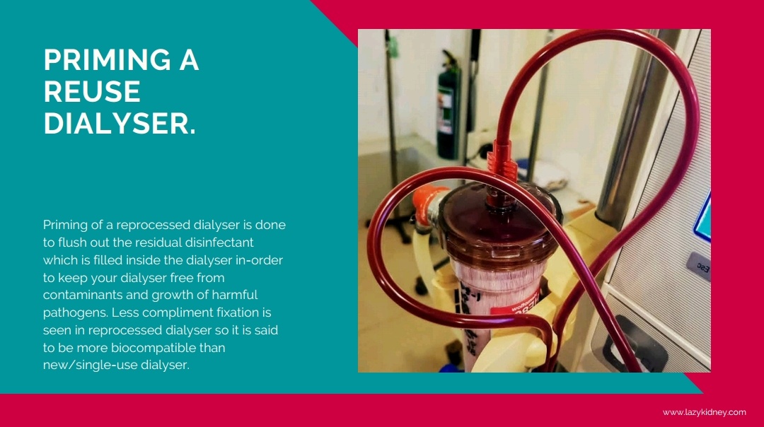 Priming a Reuse Dialyser (Reprocessed Dialyser) – LazyKidney